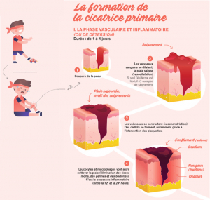 La cicatrisation - Vocation Santé