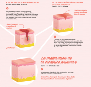 La cicatrisation - Vocation Santé