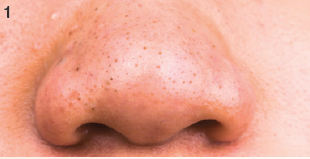 C’est quoi ce bouton ? - Vocation Santé