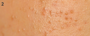 C’est quoi ce bouton ? - Vocation Santé